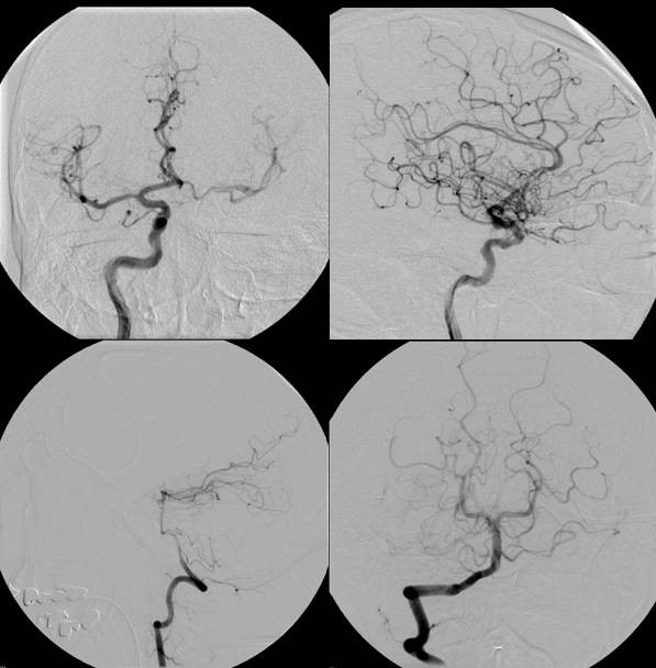 Angiographie: UMM Universitätsmedizin Mannheim